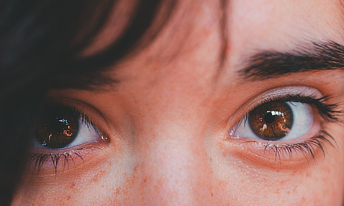 Penyebab dan Penanganan Mata Juling, Apakah Bisa Sembuh dengan ...