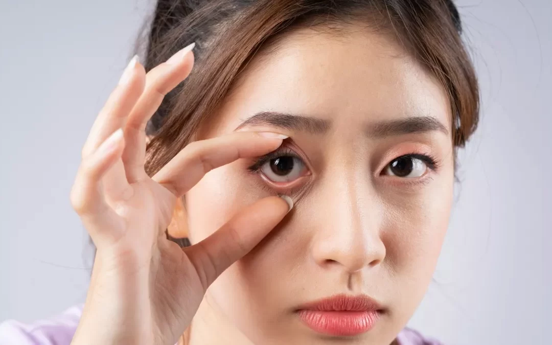 Apakah Mata Minus dan Mata Malas Adalah Gangguan yang Sama? | VIO ...