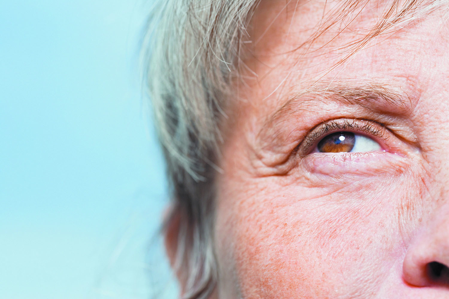 Kenali Gejala, Penyebab, dan Penanganan Eye Floaters - VIO Optical Clinic